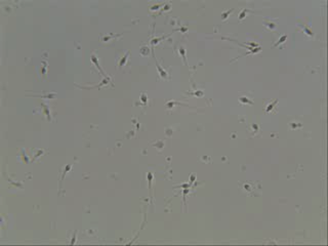 Pod Spermatozo des Observ s Au Microscope 2 Pod Spermatozo des Observ s Au Microscope 2